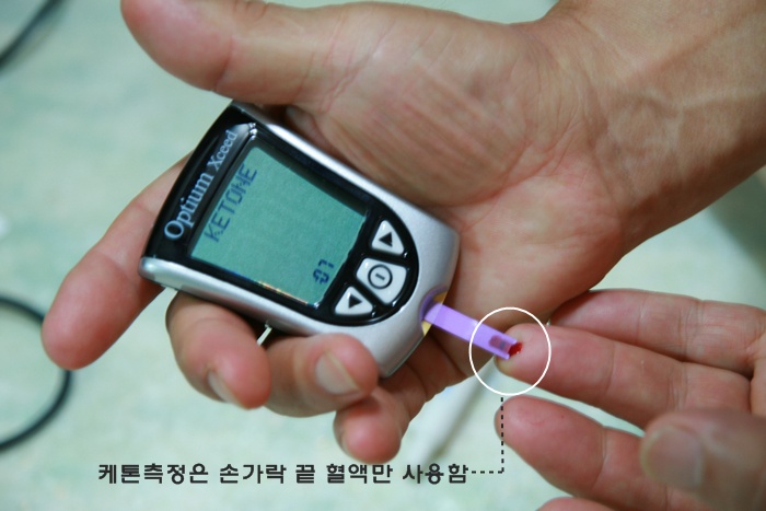 [애보트 익시드] 임신성당뇨 관리엔 케톤측정이 가능한 옵티엄 익시드로 하세요. 임신성당뇨/소아당뇨/케톤측정/익시드 무료대여 ...