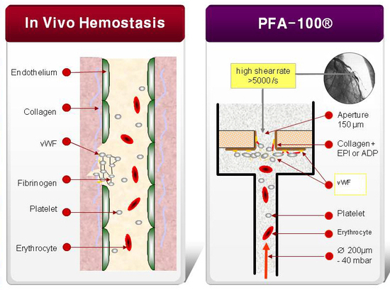 혈소판 기능 선별검사용 PFA-100 : 네이버 블로그