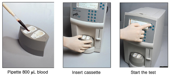 혈소판 기능 선별검사용 PFA-100 : 네이버 블로그