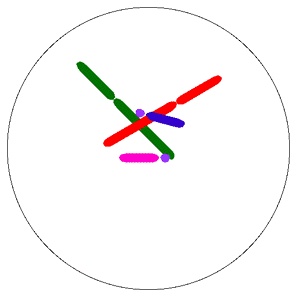 다운증후군 (Down Syndrome, Trisomy 21) 증상과 치료 : 네이버 블로그