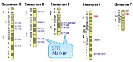 태아 염색체 이수성 신속진단을 위한 QF-PCR 형광정량법 : 네이버 블로그