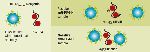 헤파린-유도 혈소판감소증(HIT)의 발생기전, 진단과 치료 : 네이버 블로그