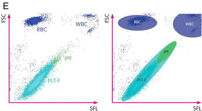 자동혈액분석기 Sysmex XN-Series -시스멕 코리아 : 네이버 블로그