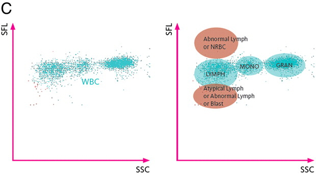 자동혈액분석기 Sysmex XN-Series -시스멕 코리아 : 네이버 블로그