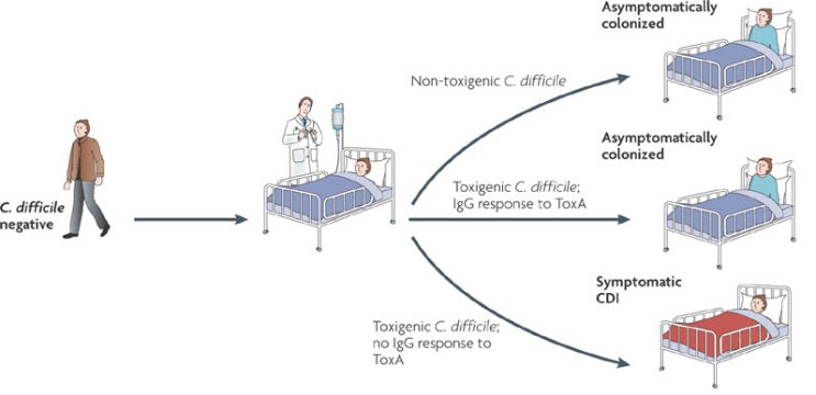 클로스트리디움 디피실(Clostridium difficile) 장염 진단과 치료 : 네이버 블로그