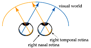 brain lesion and visual field defect : 네이버 블로그