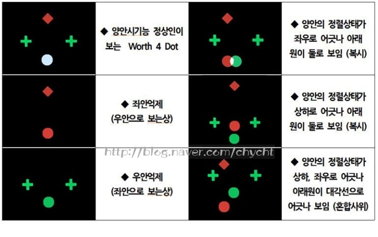 양안시 기능 검사 안경을 맞출 때 양안시 기능 검사를 해야 하는 이유 네이버 블로그