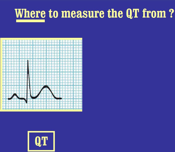 QT prolongation / QT prolongation syndrome(QT연장증후군) : 네이버 블로그