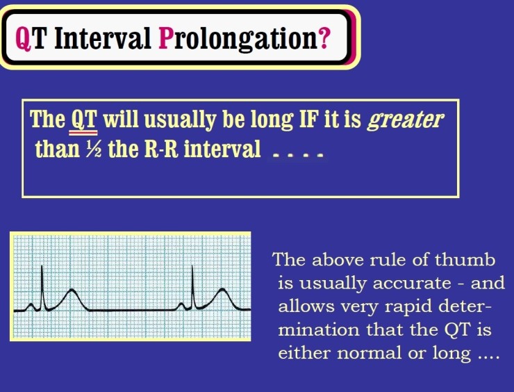 QT prolongation / QT prolongation syndrome(QT연장증후군) : 네이버 블로그