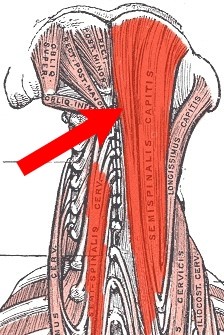 Semispinalis : 반극근 : 네이버 블로그