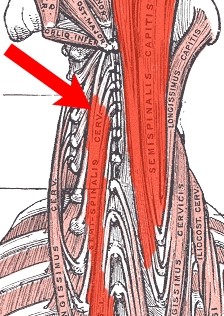 Semispinalis : 반극근 : 네이버 블로그