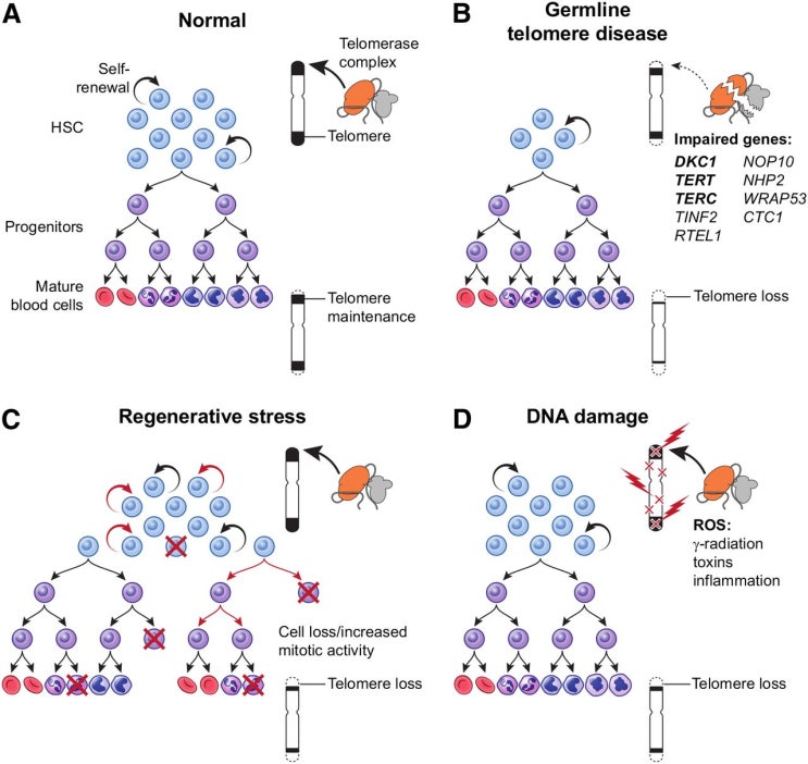 텔로미어(telomere)와 텔로머라제(telomerase), 그리고 골수부전 : 네이버 블로그