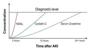 NGAL, 급성신장손상(AKI), 급성신부전의 생물학적 표지자 : 네이버 블로그