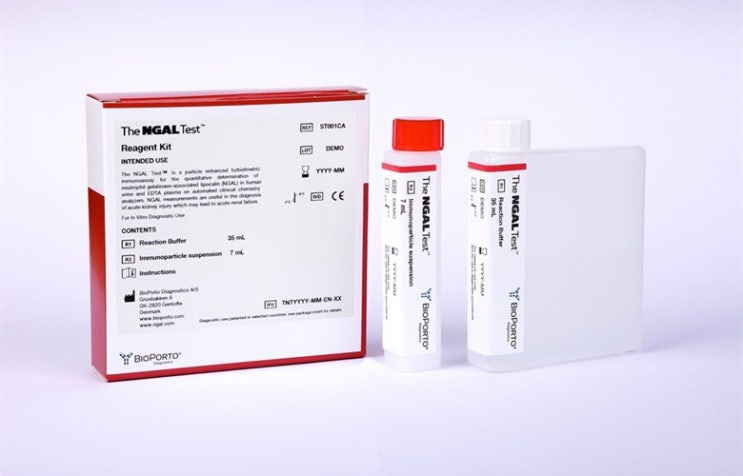 NGAL, 급성신장손상(AKI), 급성신부전의 생물학적 표지자 : 네이버 블로그