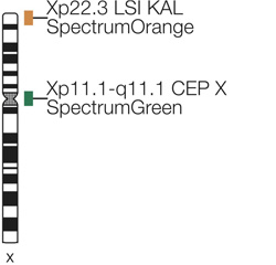 가성 동종 이중심절 X염색체, psu idic(X) : 네이버 블로그