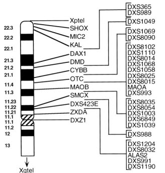 가성 동종 이중심절 X염색체, psu idic(X) : 네이버 블로그