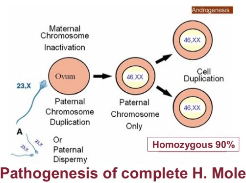 gestational trophoblastic disease(임신융모질환)- hydatidiform mole ...