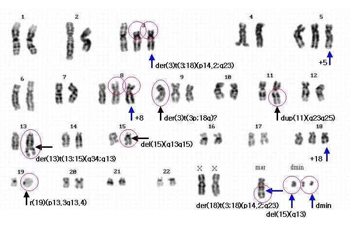 이중극미염색체 double minute chromosome (dmin) : 네이버 블로그