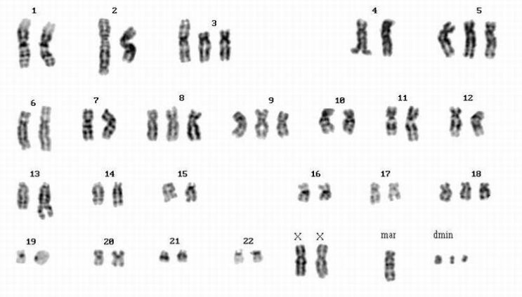 이중극미염색체 double minute chromosome (dmin) : 네이버 블로그