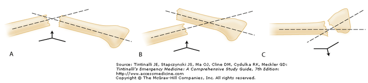 Initial Evaluation and Management of Orthopedic Injuries - 응급의학 267 ...