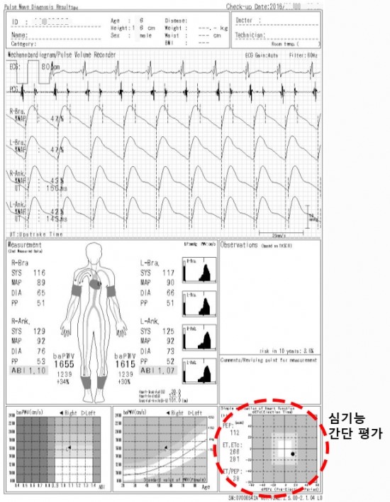 비침습적 동맥경화 검사, PWV와 ABI : 네이버 블로그