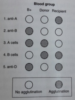 blood types : 네이버 블로그