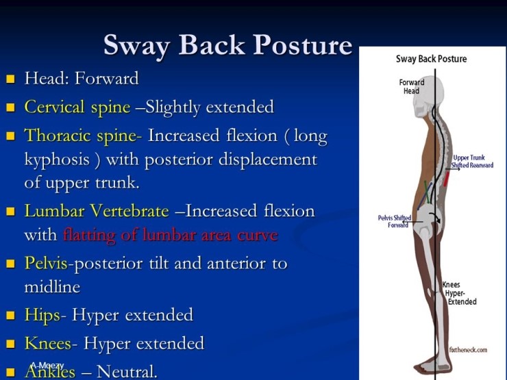 sway back 이야기(프롤로그) : 네이버 블로그