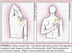 [진단학]어깨관절에 대한 이학적평가 총정리 [송파동PT][방이동PT] : 네이버 블로그