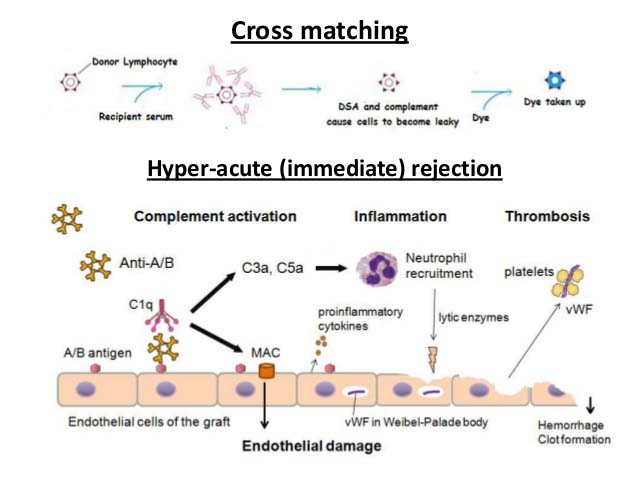 장기이식 검사 (tests for organ transplantation) 종류와 활용 : 네이버 블로그