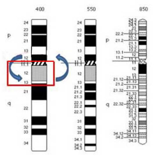 9번 염색체의 협동원체 역위 inv(9)(p11q13) : 네이버 블로그