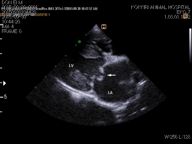 건삭 파열 (Chordae tendineae rupture) : 네이버 블로그