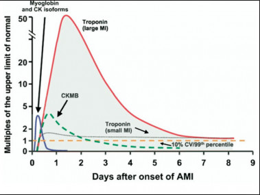 CK. MB. troponin : 네이버 블로그