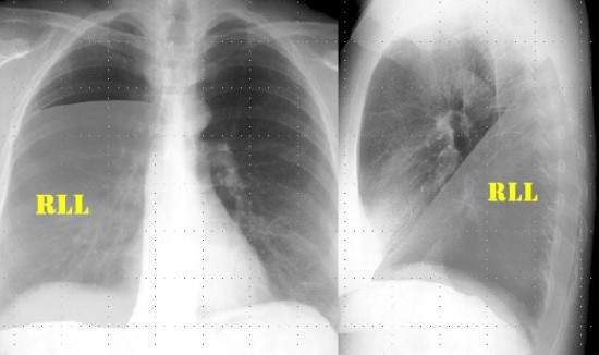 인터니스트 : 네이버 블로그