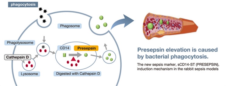 프레셉신(Presepsin, sCD14-ST) 검사적 특성과 임상적 의의 : 네이버 블로그