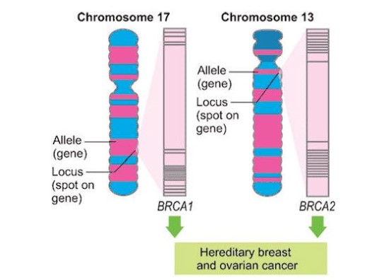 유전성 유방암 난소암과 BRCA 유전자 변이 : 네이버 블로그