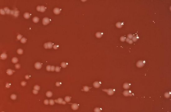 장내세균, 시트로박터 프룬디균(Citrobacter freundii)의 성상 : 네이버 블로그