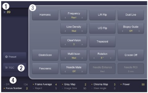 초음파장비의 컨트롤패널, 모니터, 화면 조절(gain과 TGC) : 네이버 블로그