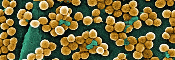 MRSA,VRE를 완전 극복할 테익소박틴(teixobactin) 유사체 개발 : 네이버 블로그