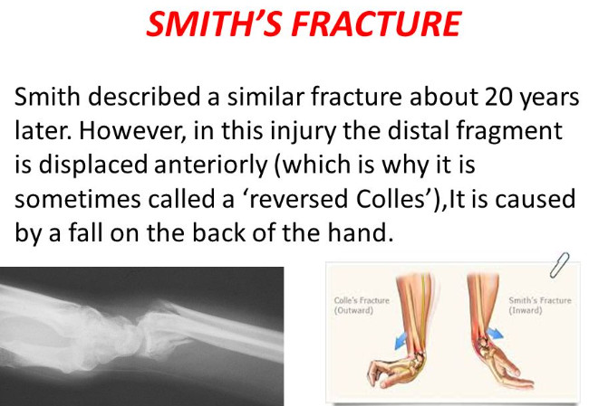 Garden Spade Deformity Picture | Fasci Garden