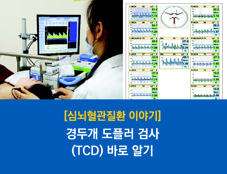 [심뇌혈관질환 이야기] 경두개 도플러 검사(TCD : Transcranial Doppler) 바로 알기 : 네이버 블로그