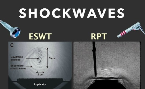 체외충격파(ESWT)의 종류 : 네이버 블로그