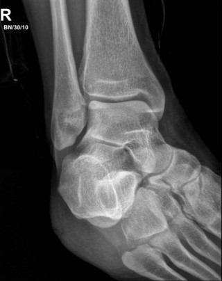 Brodens view : 네이버 블로그