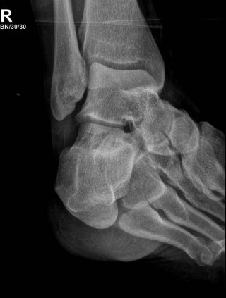 Brodens view : 네이버 블로그