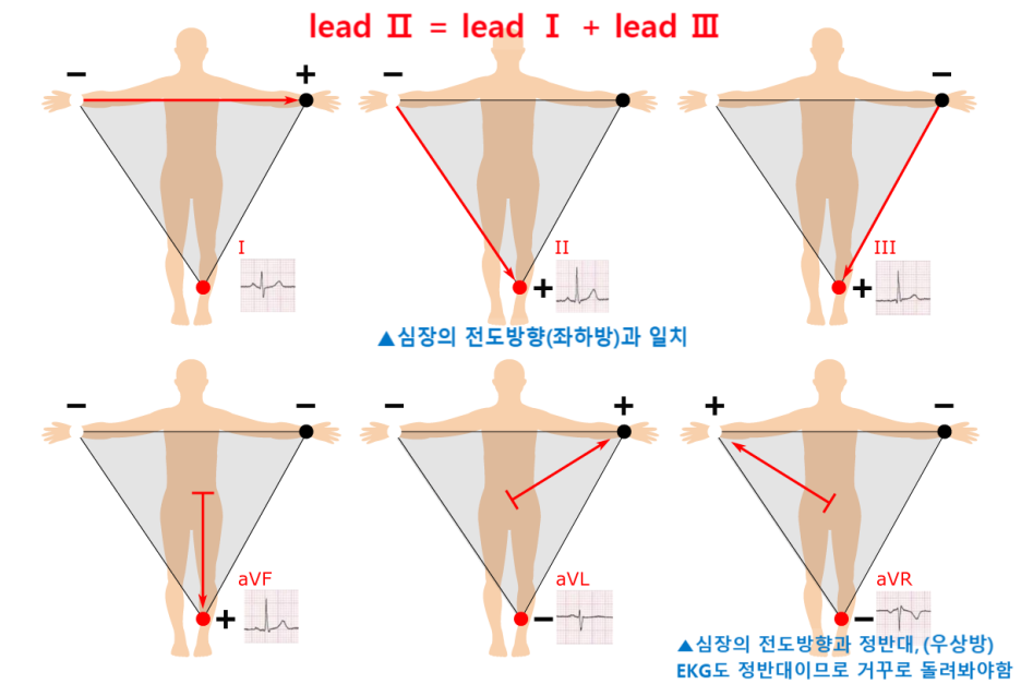 Step2. 12 lead EKG의 기본 : 네이버 블로그