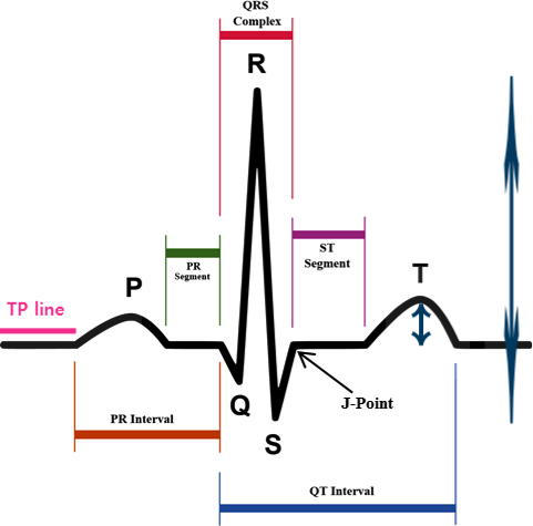 Step1. ECG의 기본(P-QRS-T) : 네이버 블로그