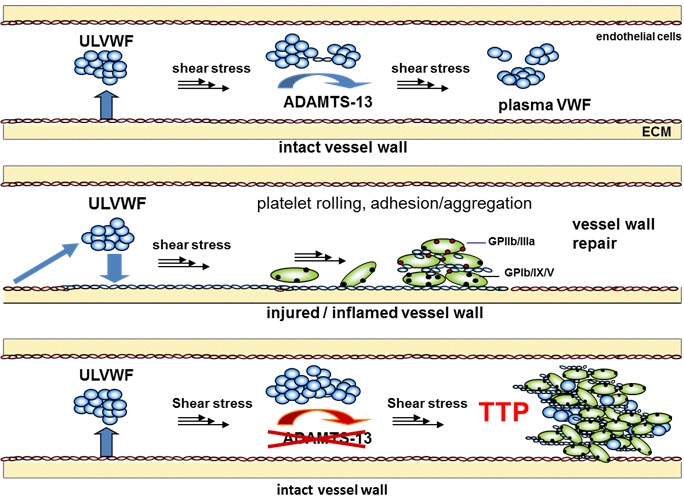 ADAMTS13 활성도검사, 혈전성 미세혈관병증(TTP, aHUS) 감별진단 : 네이버 블로그