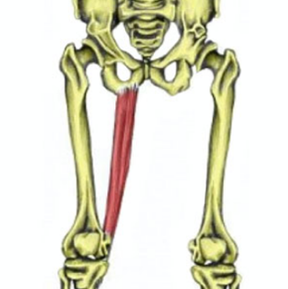허벅지 안쪽, 사타구니 통증, / 박근,두덩정강근 통증유발점(Gracilis Trigger Point) : 네이버 블로그