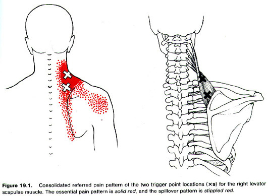목어깨통증, 왼쪽 목과 어깨 사이쯤에 통증이 있어요 : 네이버 블로그