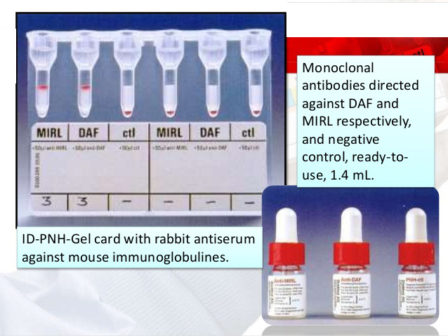 발작성야간혈색뇨증(PNH) 병인론적 기전과 진단검사 : 네이버 블로그