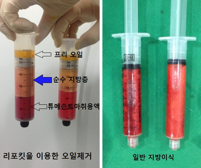[리포킷주사기] 리포킷시린지, 리포킷시린지정품, 리포킷실린지, lipokit syringe, TP101 SYRINGE, 리포킷 ...